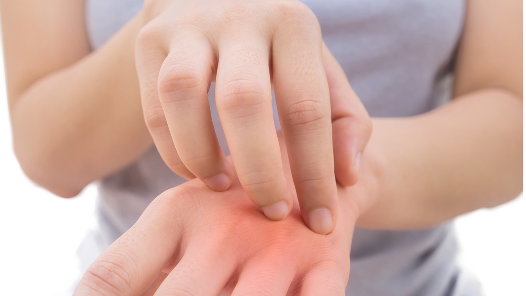 The Most Common Causes of Skin Rash from Cleaning Products